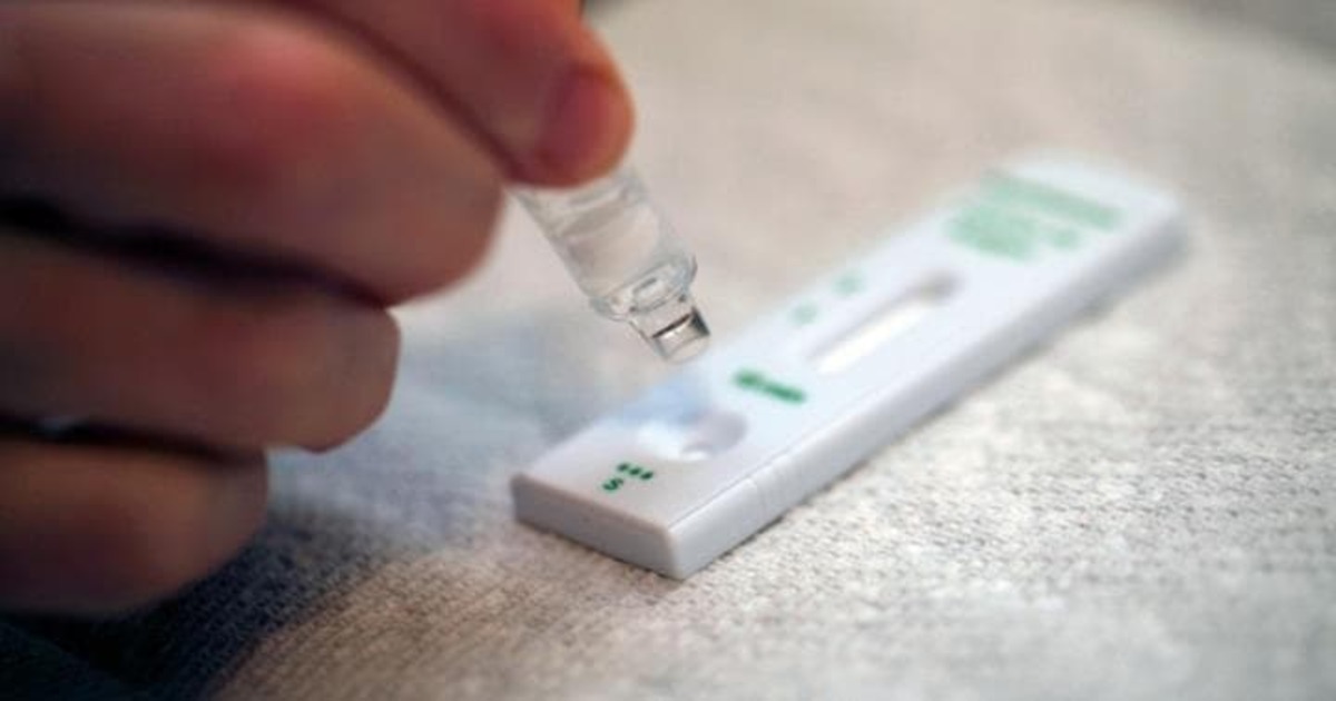 防疫概念股暗藏黑馬股！新冠檢測商機大，6645 業績轉虧為盈，後市看俏-Money錢 | CMoney投資網誌